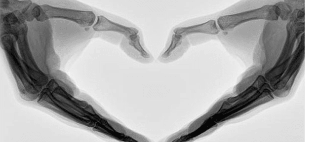 PIH Bone Health Part 1: Principles | PERQUE